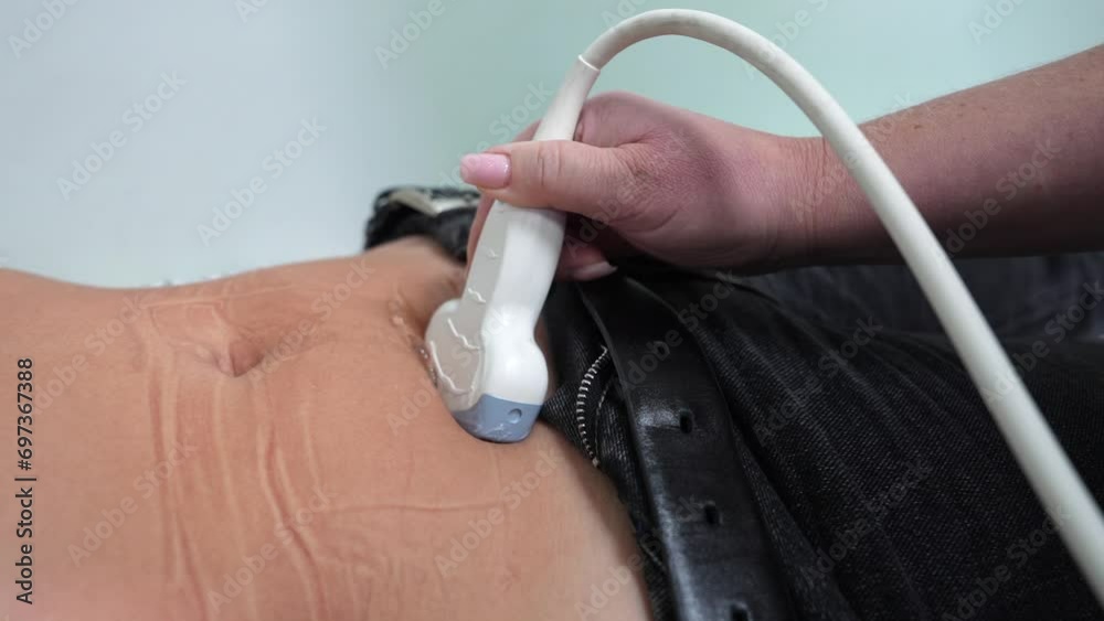 Abdominal ultrasound. Close-up of doctor's hand with ultrasound probe ...