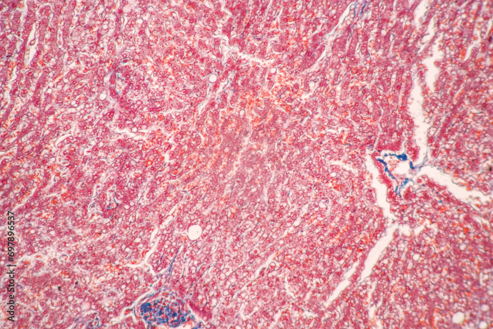 Structure of Tissue of Spleen Human, Liver Human and Kidney Human under ...