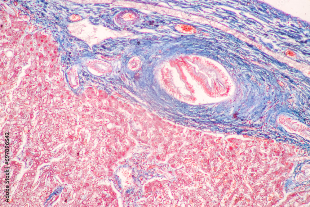 Structure of Tissue of Spleen Human, Liver Human and Kidney Human under ...
