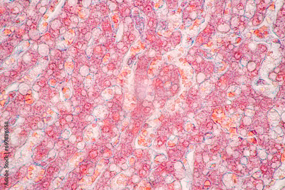 Structure of Tissue of Spleen Human, Liver Human and Kidney Human under ...