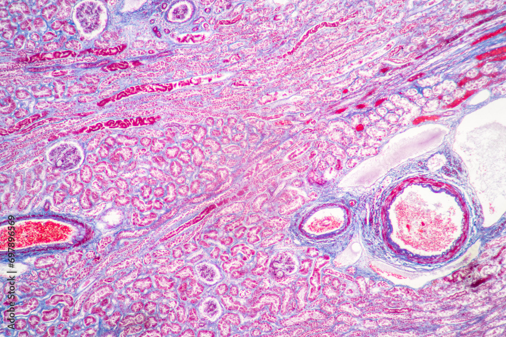 Structure of Tissue of Spleen Human, Liver Human and Kidney Human under ...