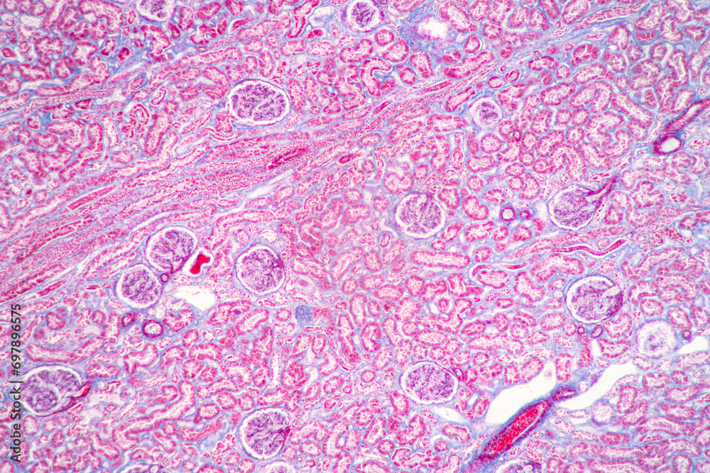 Structure of Tissue of Spleen Human, Liver Human and Kidney Human under ...