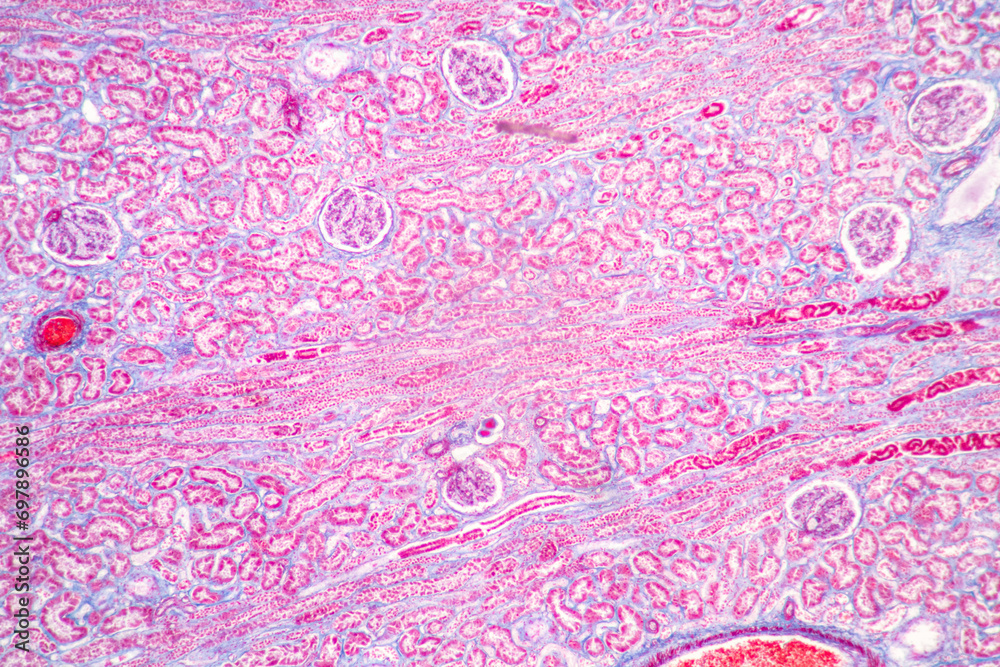 Structure of Tissue of Spleen Human, Liver Human and Kidney Human under ...