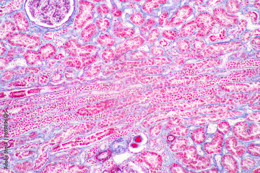 Structure of Tissue of Spleen Human, Liver Human and Kidney Human under ...