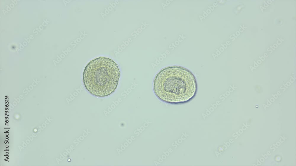 Larvae sea urchin Strongylocentrotus pallidus under microscope, phylum ...