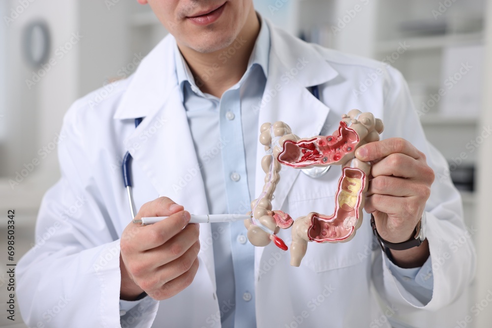 Gastroenterologist showing anatomical model of large intestine in ...
