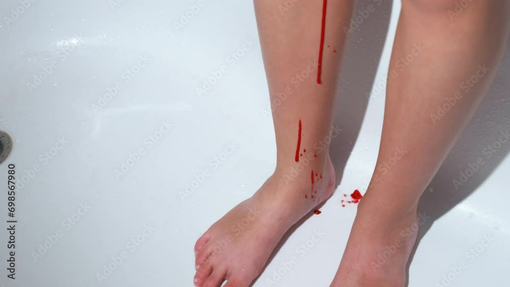 Menstruation. A girl suffers from bleeding during her period. View of a ...