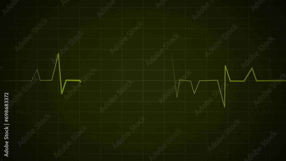 4k animation heart beat with line on background. 4k seamless loop ...