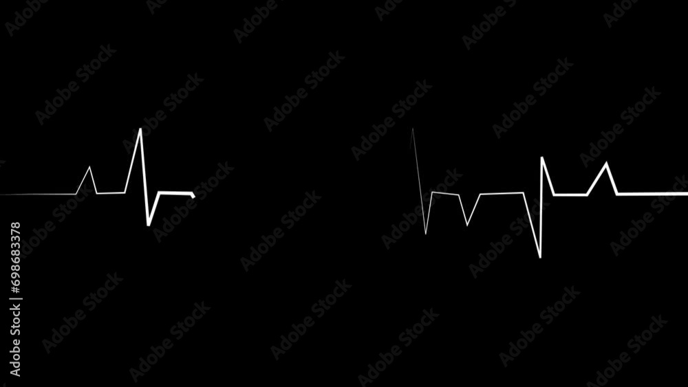 4k animation heart beat with line on background. 4k seamless loop ...