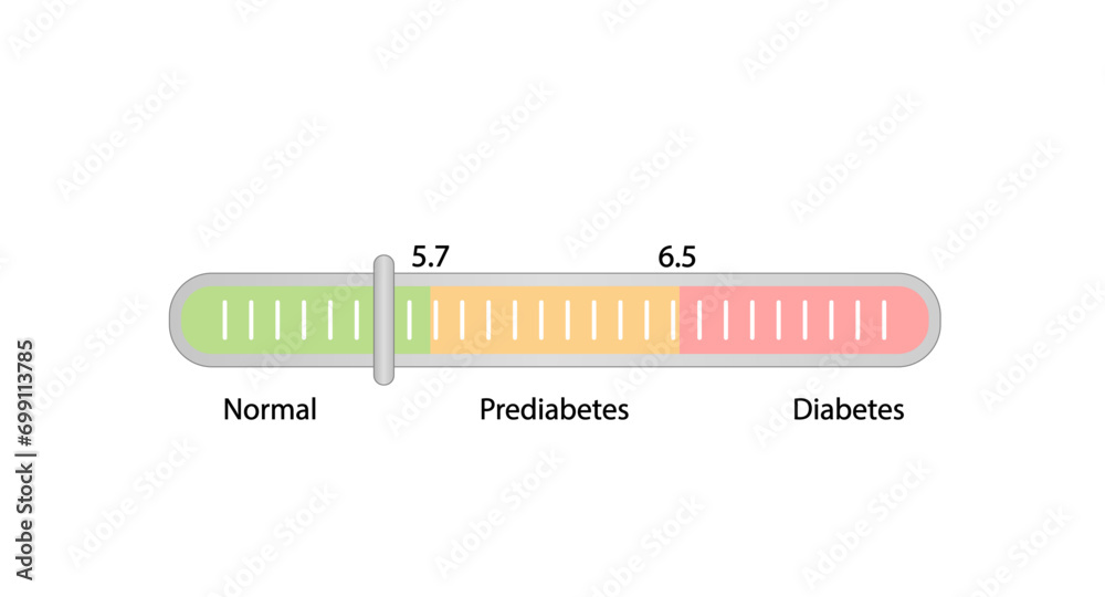 Hemoglobin A1C, HbA1c test results, glycated hemoglobin, A1C Blood ...