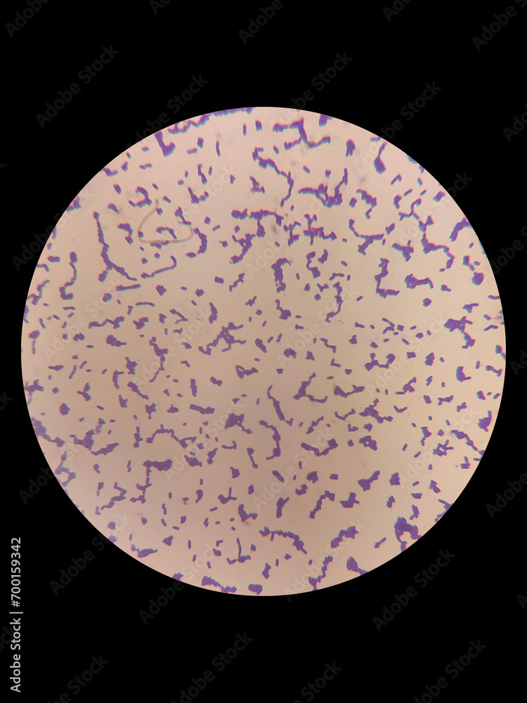 Lactic acid bacteria under a microscope, gram staining Stock Photo ...