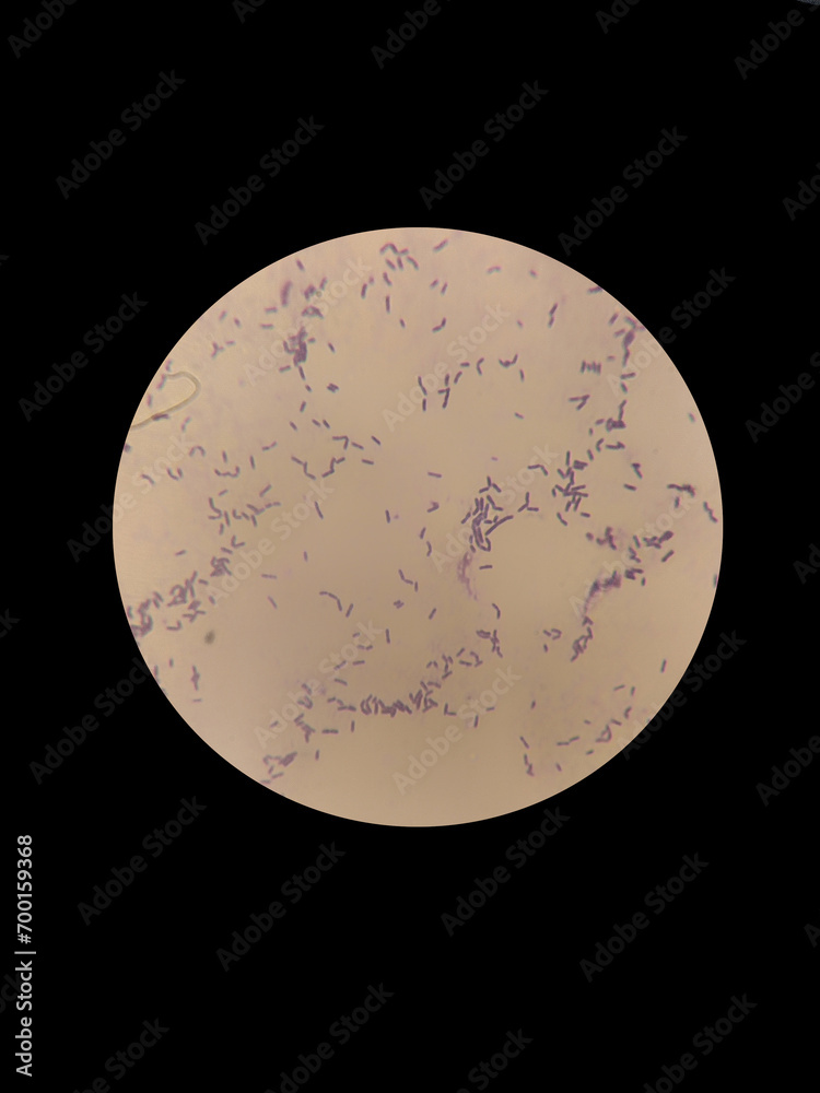 Lactic acid bacteria under a microscope, gram staining Stock Photo ...