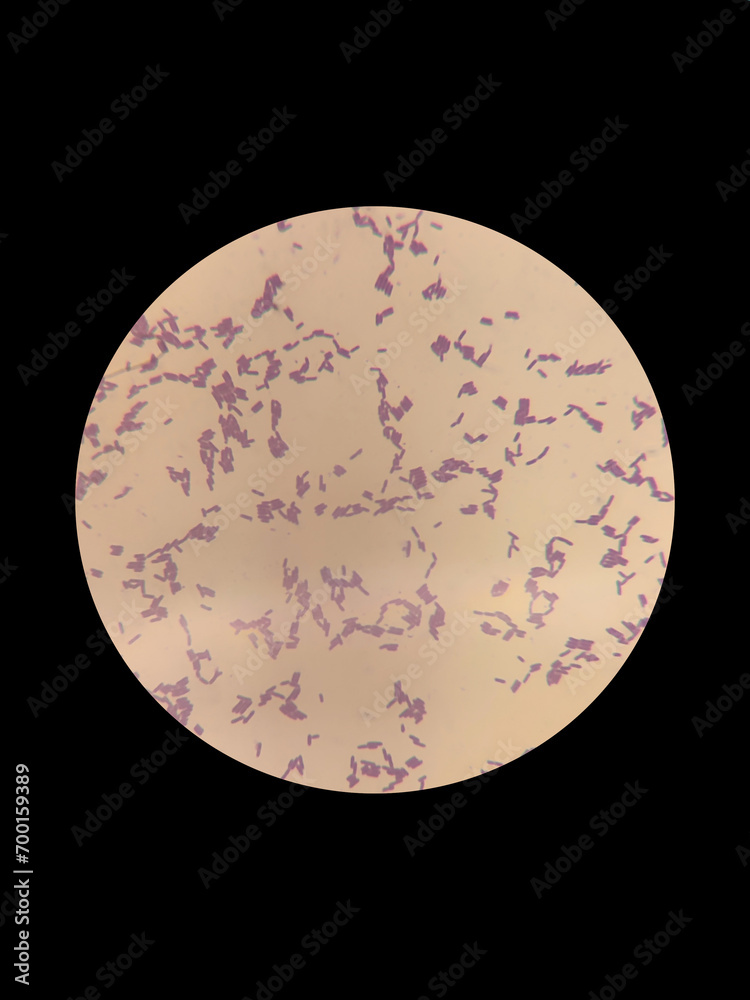 Lactic acid bacteria under a microscope, gram staining Stock Photo ...