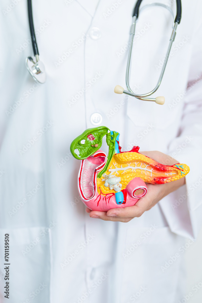 Doctor with human Pancreatitis anatomy model with Pancreas, Gallbladder ...