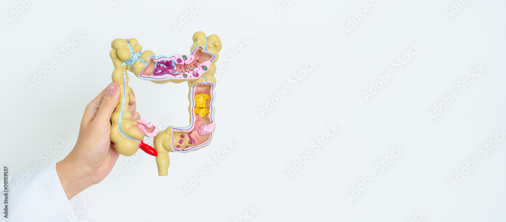 Doctor with human Colon anatomy model. Colonic disease, Large Intestine ...