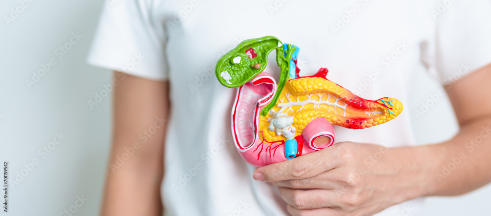 Woman holding human Pancreatitis anatomy model with Pancreas ...