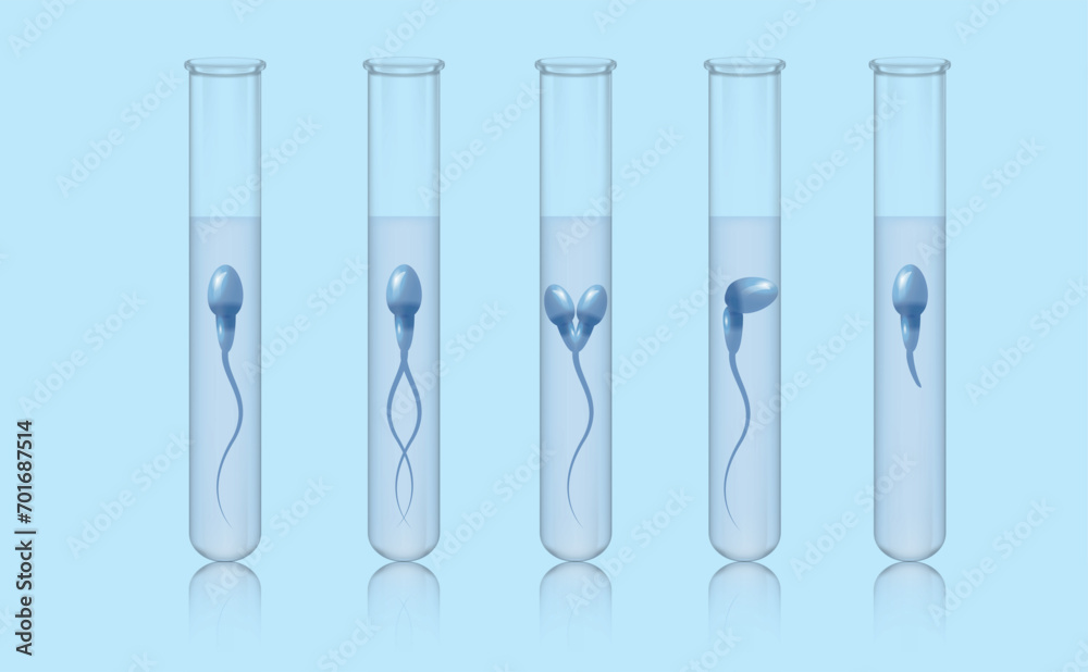 Morphology, spermatazoid in a medical test tube. A set of test tubes ...
