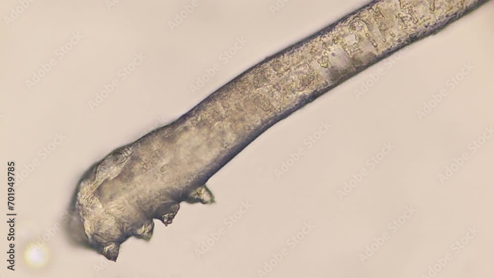 high resolution footage of face mite demodex under the microscope vídeo ...