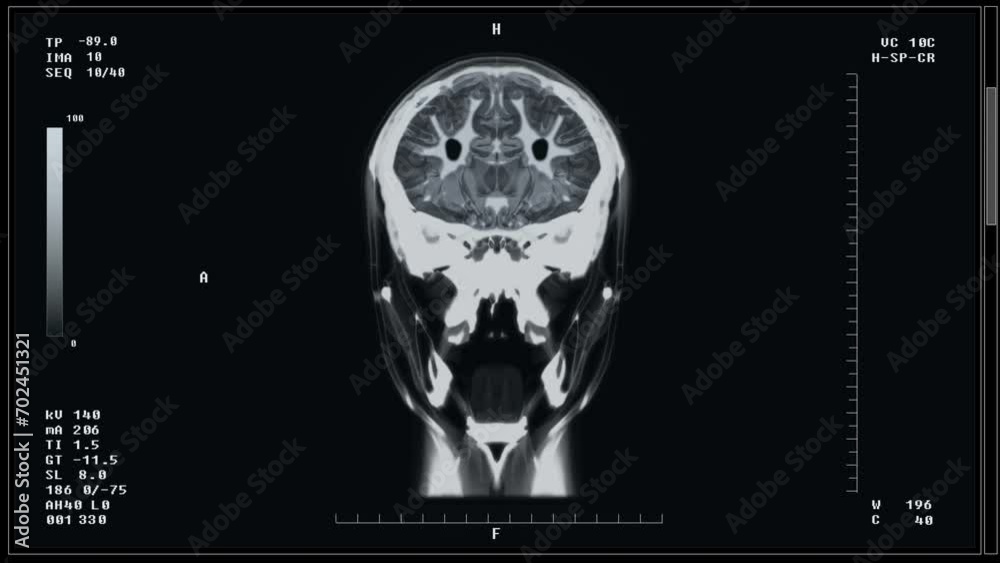 Hospital scanner used for the diagnostic of the sick patients skull ...