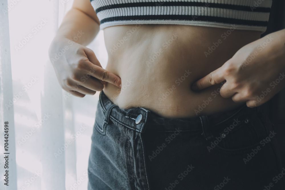 Women body fat belly. Obese woman hand holding excessive belly fat ...