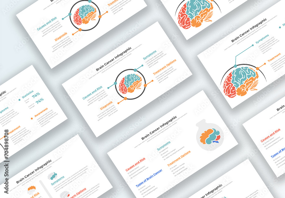 Brain Cancer Infographic Stock Template | Adobe Stock