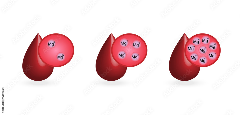 hypermagnesemia, high plasma magnesium level and hypomagnesemia, low ...