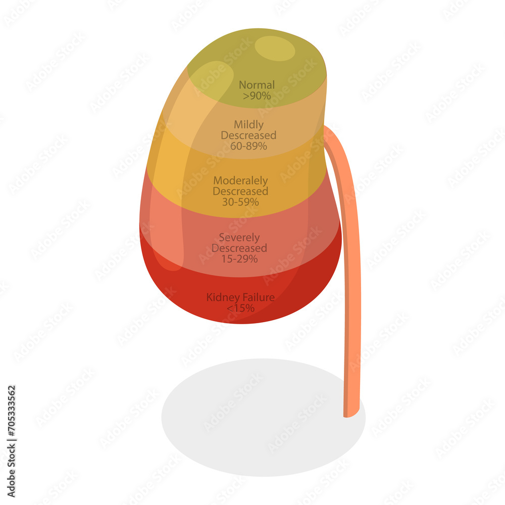 3D Isometric Flat Conceptual Illustration of Chronic Kidney Disease ...