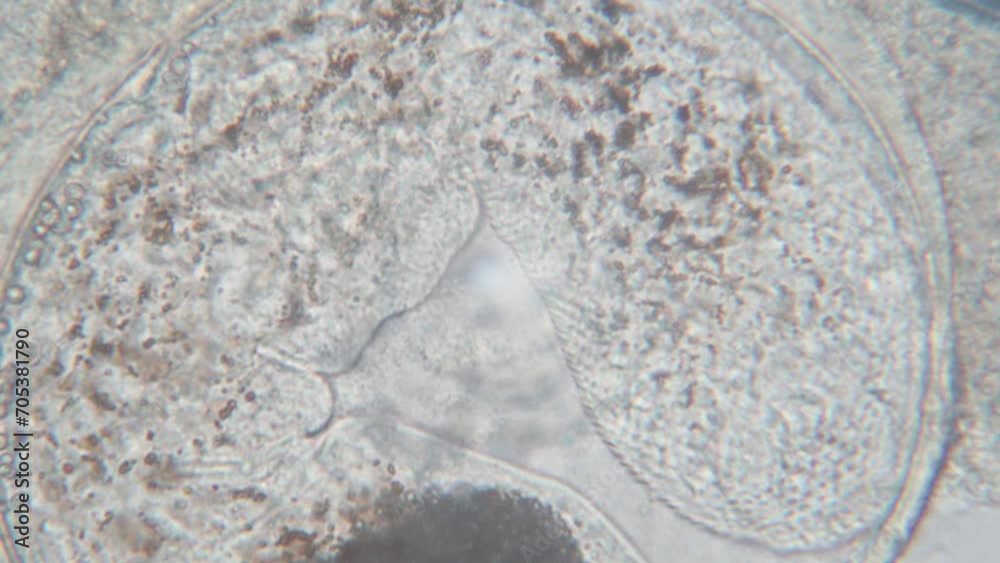 Vidéo Stock Study of Parasitic helminths (Trematodes) of marine fishes ...