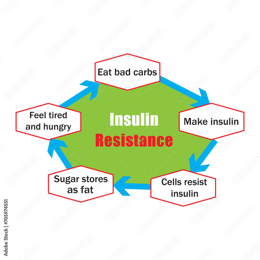 Insulin cycle before and after eat. Insulin resistance diagram. Vector ...