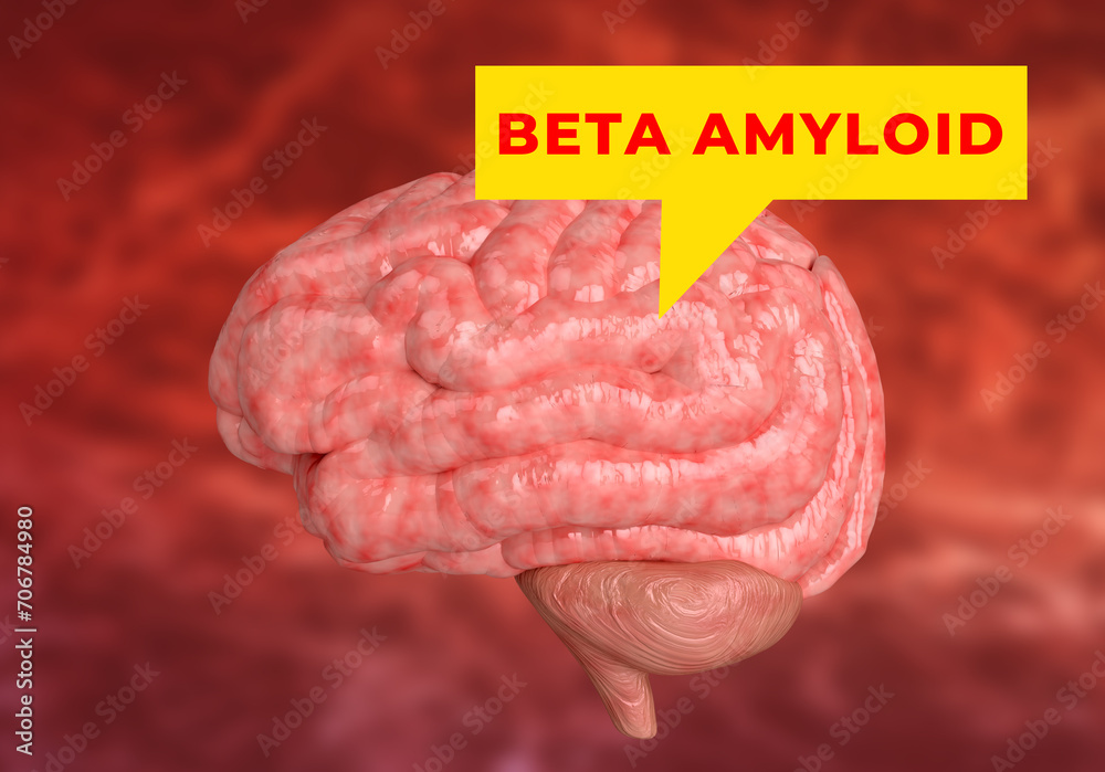 Beta Amyloids are peptides with 36-43 amino acids and the main ...