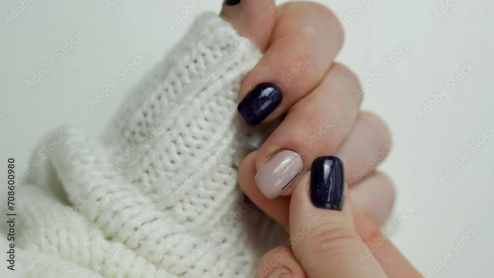 The fungal nail disease is paronychia. Purulent abscess on the finger ...