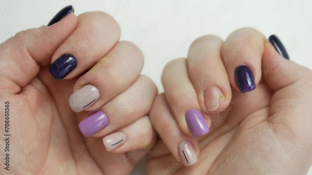 Women's hands with a beautiful manicure and a fungal nail disease ...
