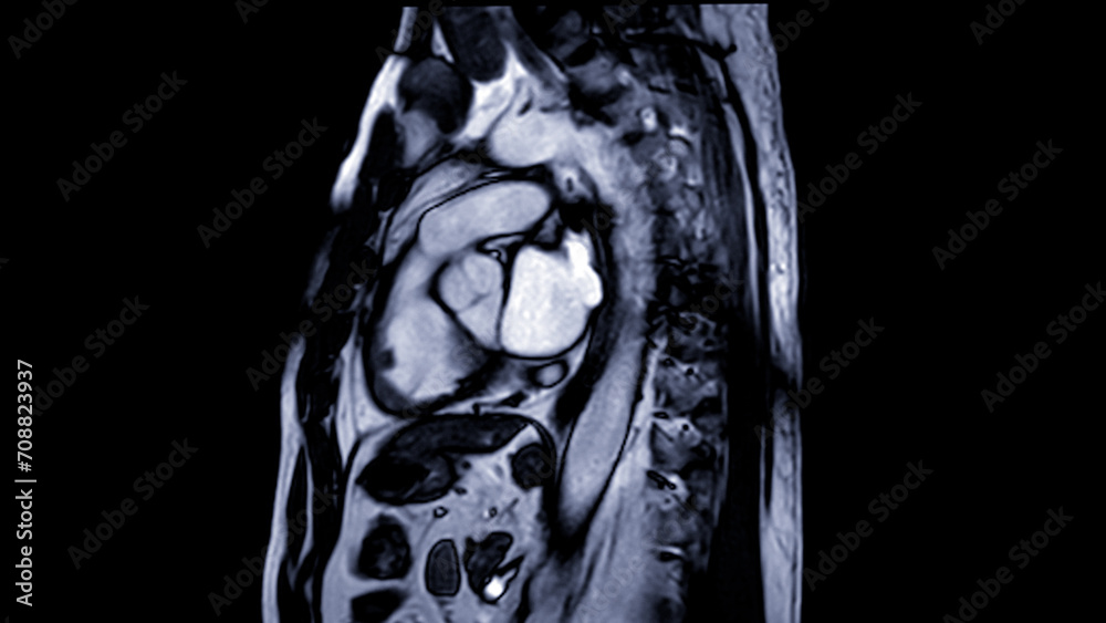 Cardiac MRI images are instrumental in assessing cardiac health ...