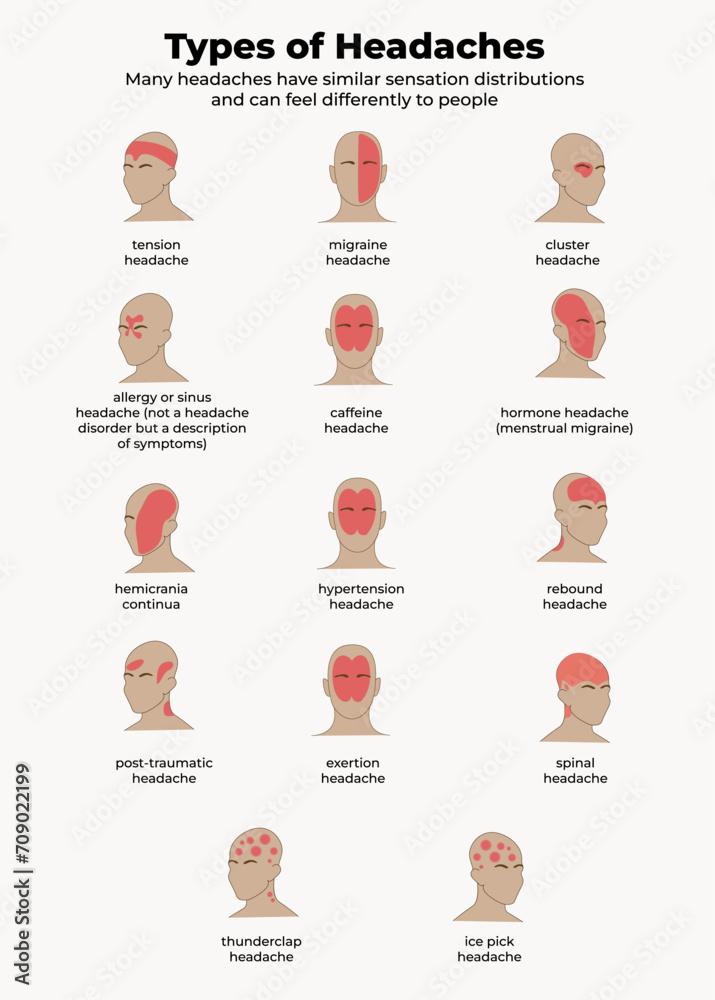 Types of headache. medical poster and infographic.neurology information ...