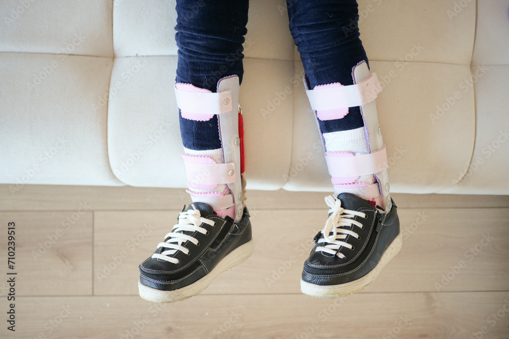 Child cerebral palsy disability, legs orthosis. Stock Photo | Adobe Stock