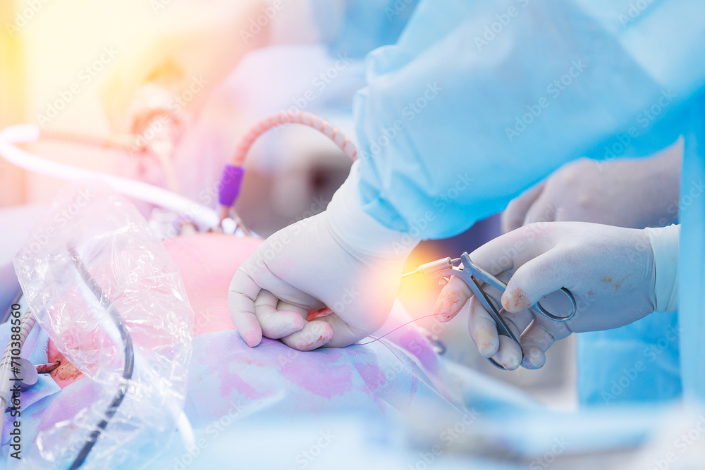 Doctor surgeon holding laparoscopic instrument in abdomen of patient ...