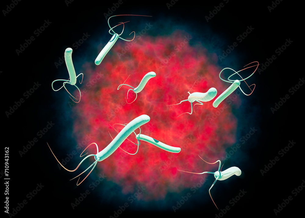 Helicobacter pylori is a gram-negative, flagellated, helical bacterium ...
