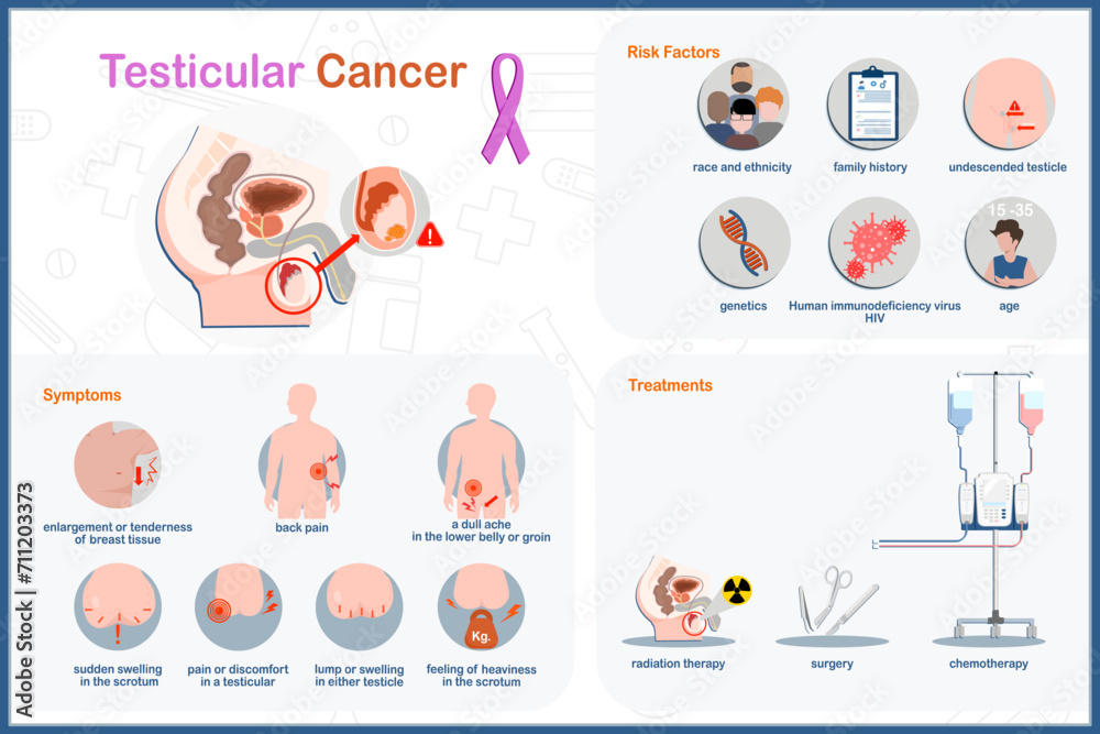 Infographic medical vector illustration. Health care concept. Testicle ...