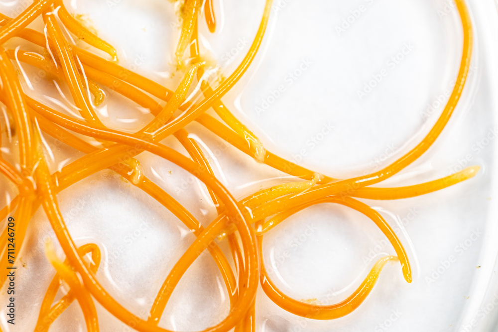 Foto de Study of Parasitic helminths (Trematodes) and Ascaris of fishes ...