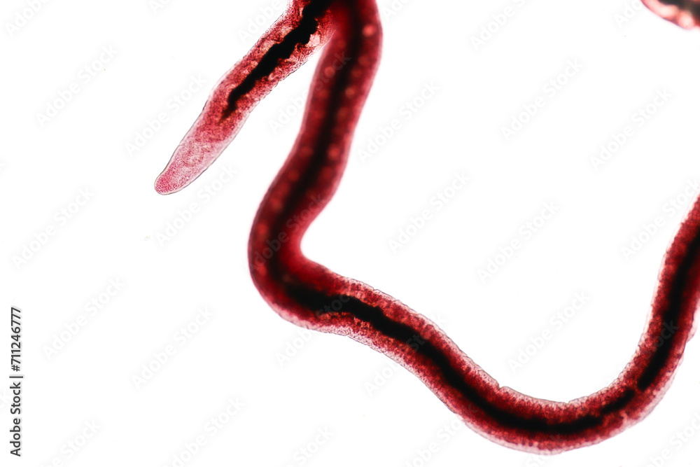 Study of Parasitic helminths (Trematodes) and Ascaris of fishes under a ...