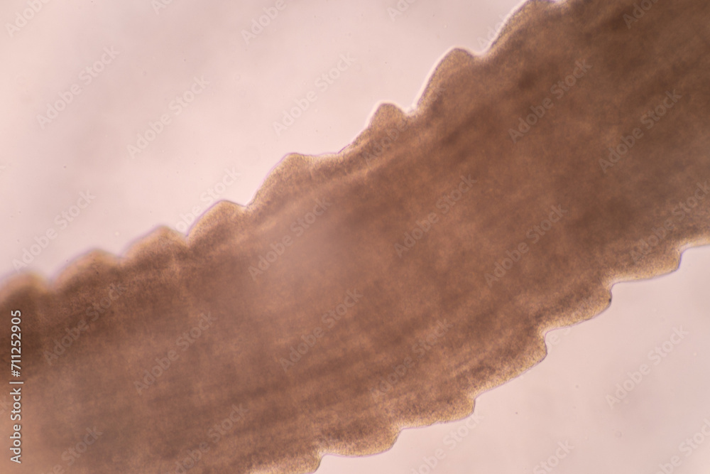 Tapeworms (Cestoda: Caryophyllidea), Parasites of Fish in Thailand ...