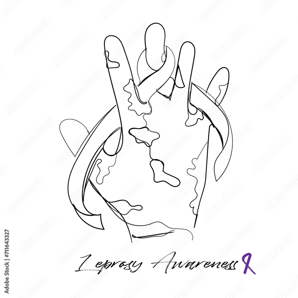 hand drawn line art vector of leprosy day. Spread leprosy awareness and ...