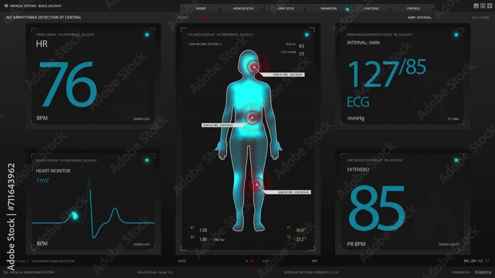 Mockup Screen Template: Software Displaying Vital Activities for ...