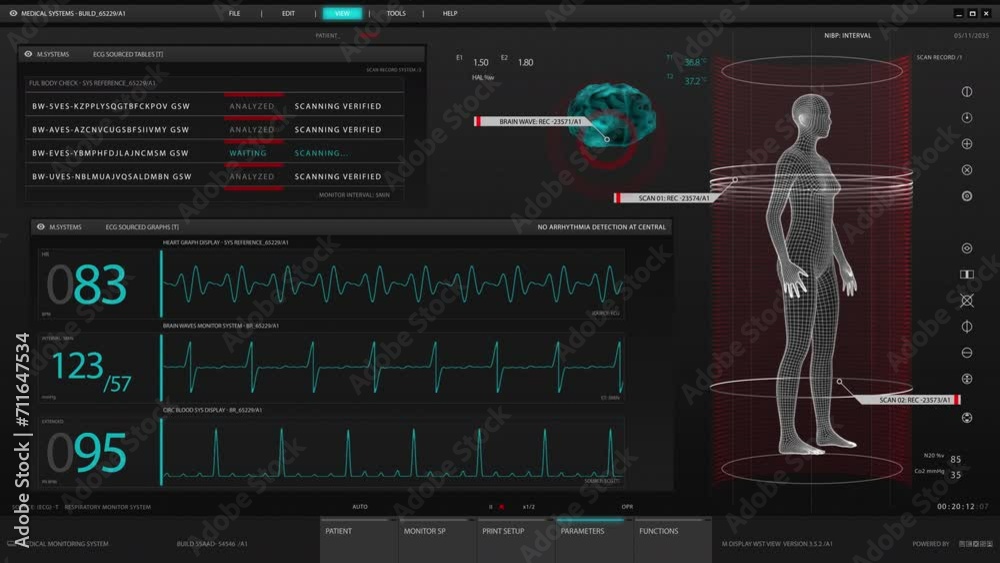 Software Displaying Vital Activities for Hospital Female Patient ...