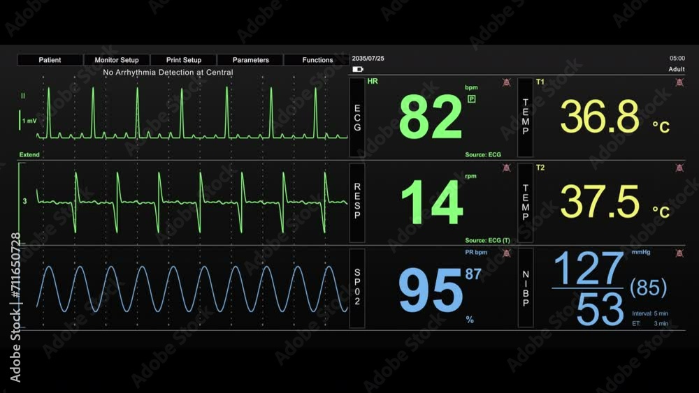 Vital Signs Monitor with Heart Rate and Other Medical Parameters on an ...