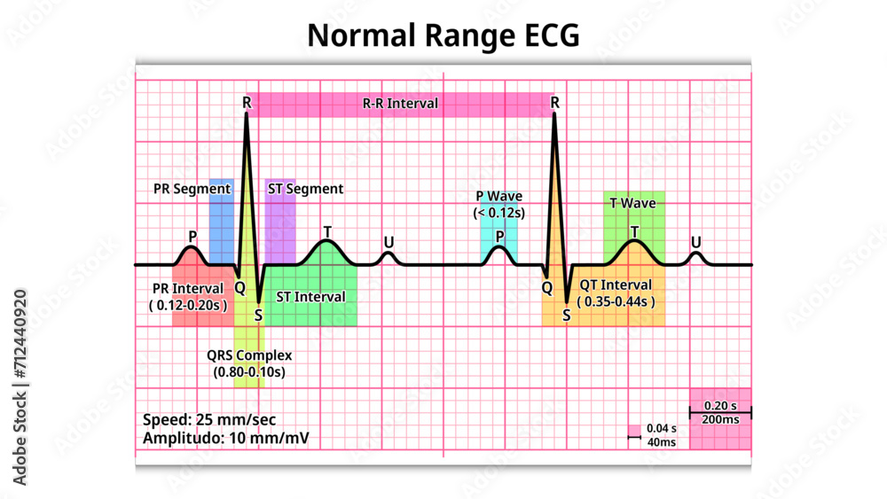 Normal Range ECG - PR Interval, QRS Complex, QT Interval, P and T Wave ...