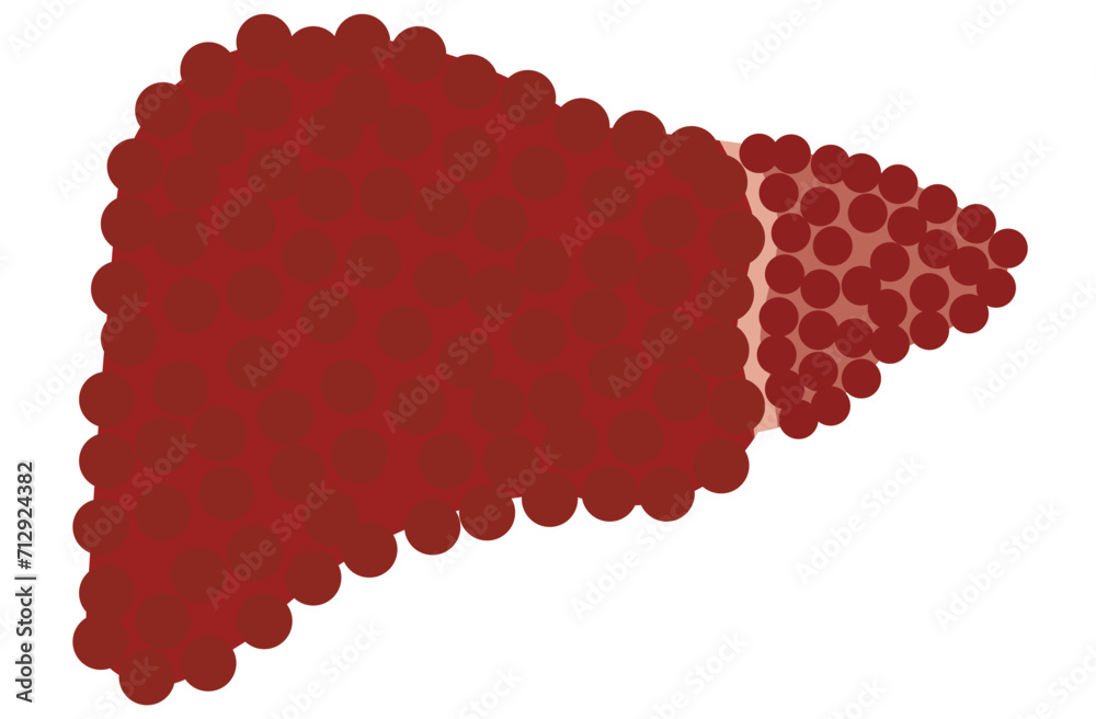 liver, cirrhosis disease. Human liver organ anatomy vector illustration ...