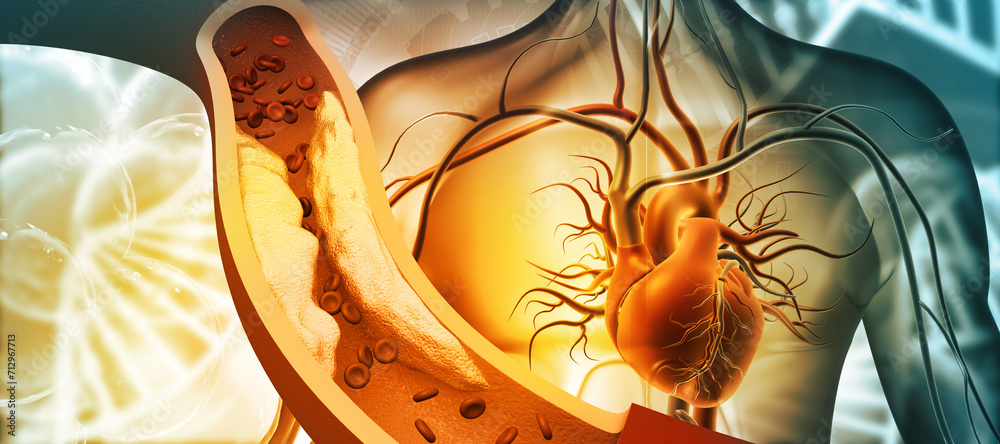 Human heart with Clogged arteries on scientific background. 3d ...