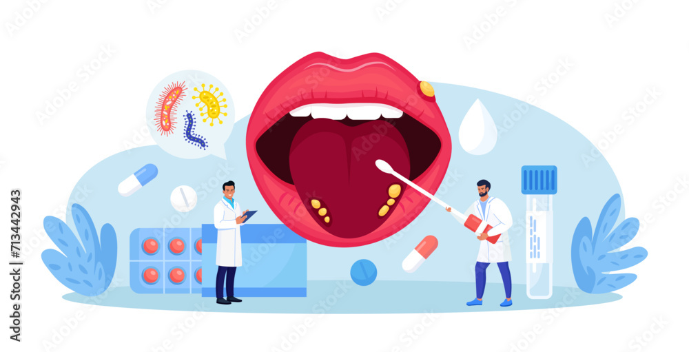 Herpes simplex virus on human lips. Dermatological disease with watery blisters in the skin. STD ...