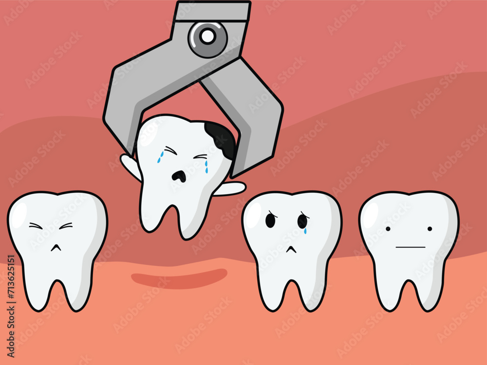 The tooth extraction illustration shows a dentist using specialized ...